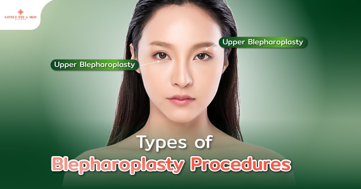 Blepharoplasty Surgery in Thailand for Youthful and Bright Eyes